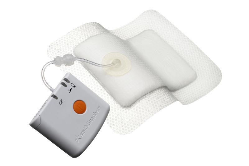 Smith and Nephew PICO Single Use Negative Pressure Wound Therapy System ...